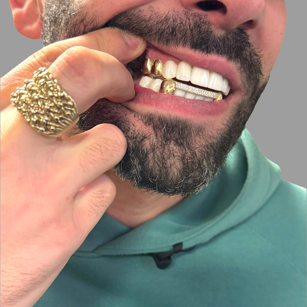 Diamond caps – MKGRILLZ LTD